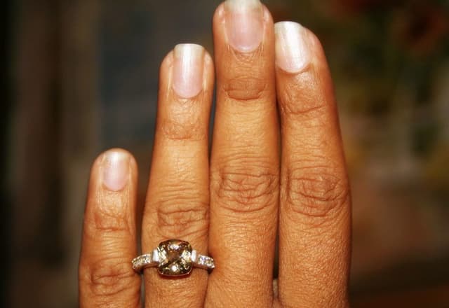 The shape of your fingers tells your future, know your destiny like ...